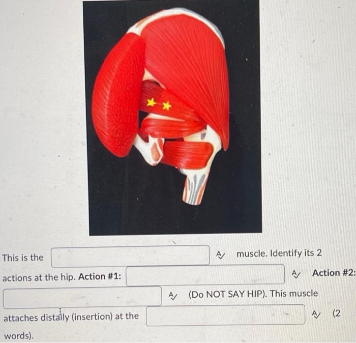 Solved Identify the muscle proximal attachment at the | Chegg.com