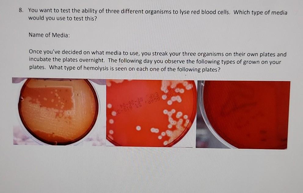 Biochemical Tests Lab Exercise: 1. Fill in the | Chegg.com