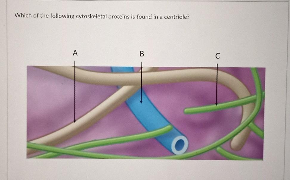 Solved Which of the following cytoskeletal proteins is found | Chegg.com