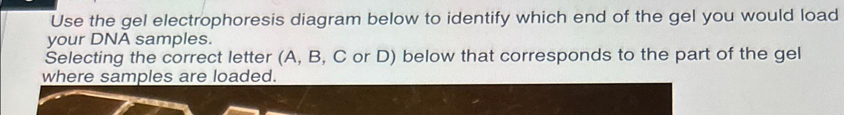 Solved Use the gel electrophoresis diagram below to identify | Chegg.com