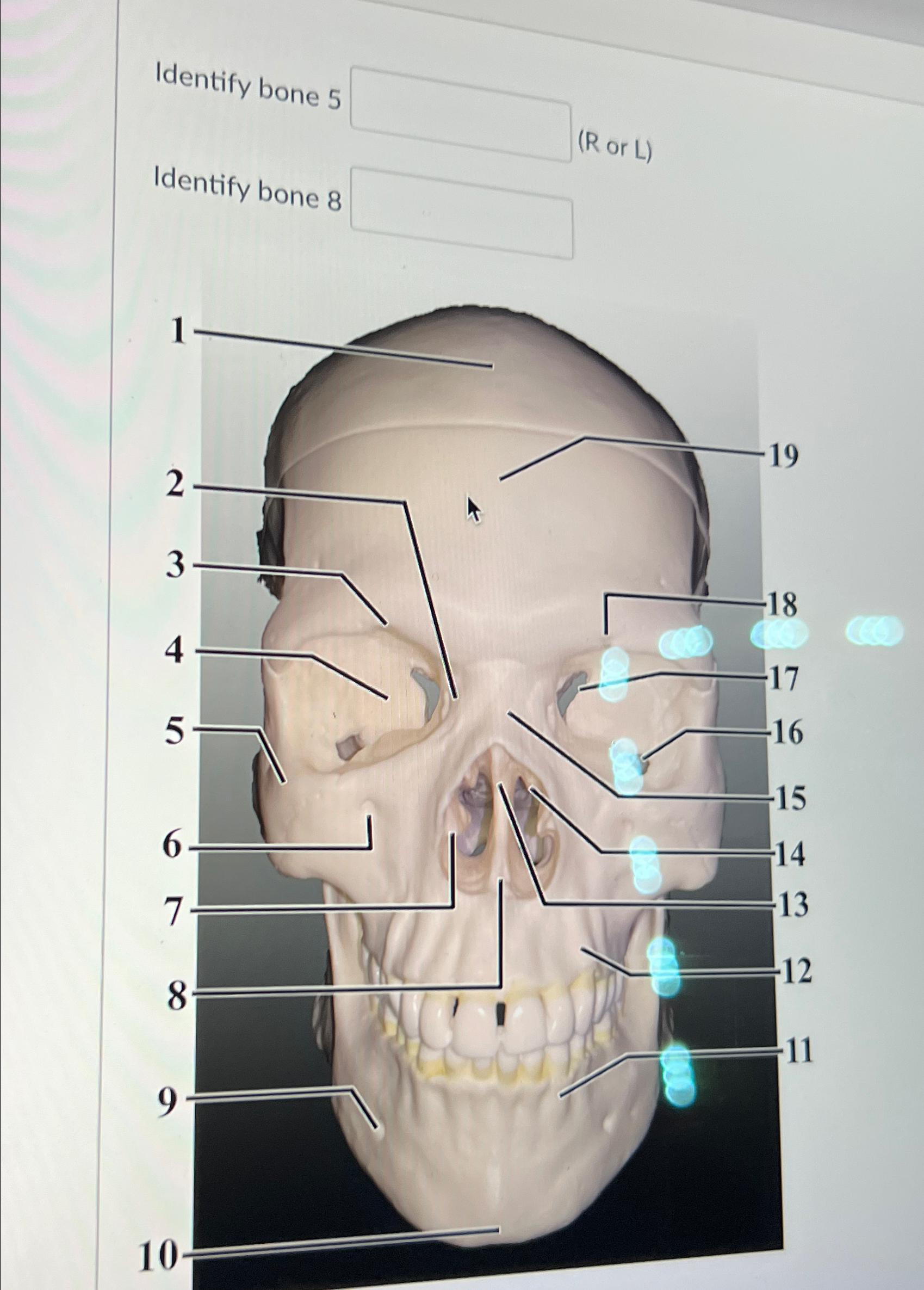 Solved Identify bone 5 (R or L)Identify bone 8 | Chegg.com