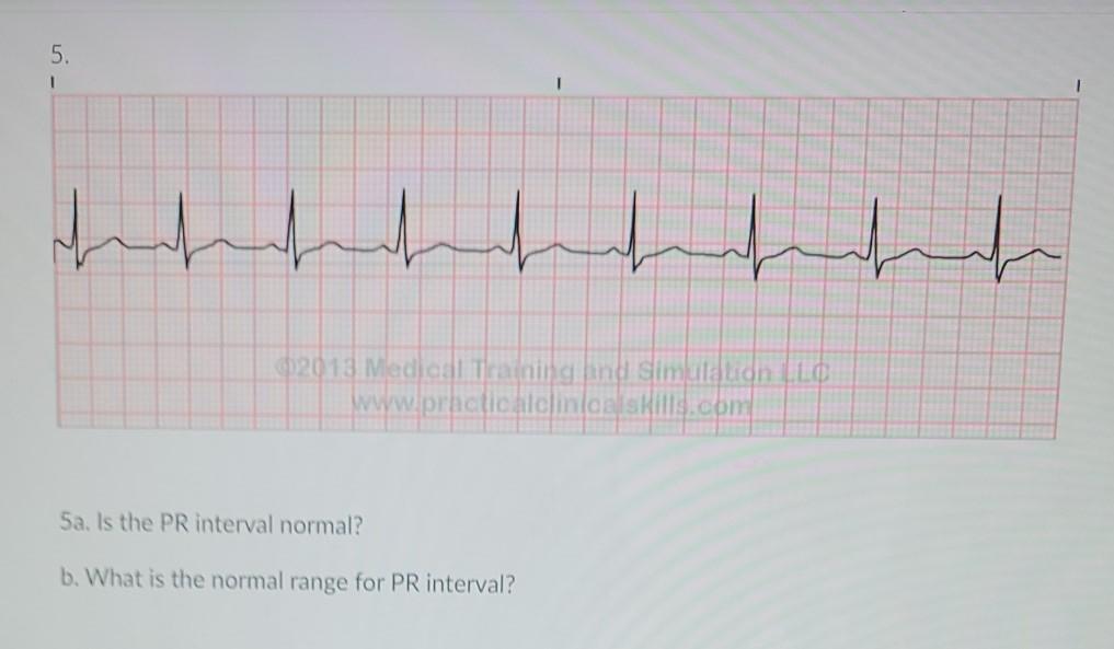 Solved 5. 1 2013 Madial Training and simulation LLD | Chegg.com