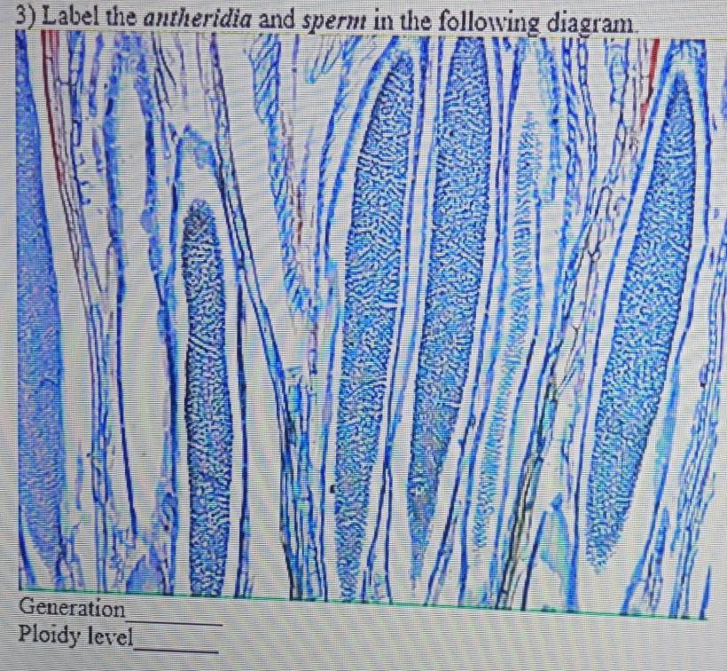 Solved 3) Label the antheridia and sperm in the following | Chegg.com
