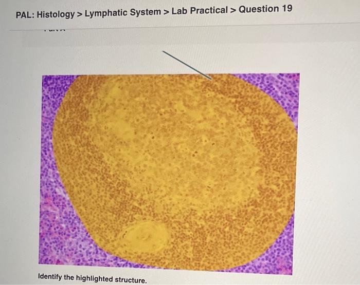 Solved Id PAL: Histology > Lymphatic System > Lab Practical | Chegg.com