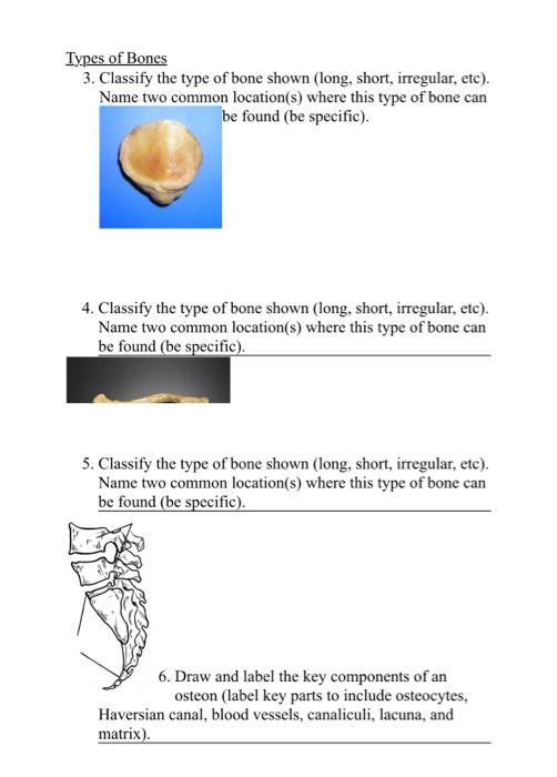 Solved Classify The Type Of Bones Shown Classify The Type