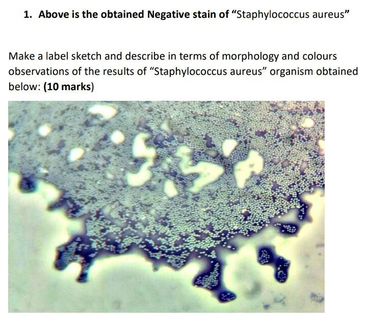 Solved 1. Above is the obtained Negative stain of | Chegg.com