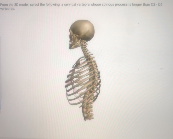 Solved From the 3D model, select the following: a cervical | Chegg.com