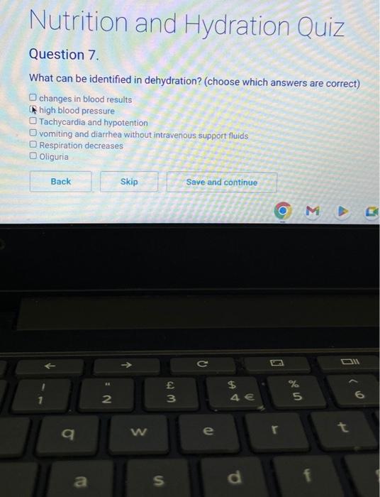 Solved Nutrition and Hydration Quiz Question 7. What can be | Chegg.com