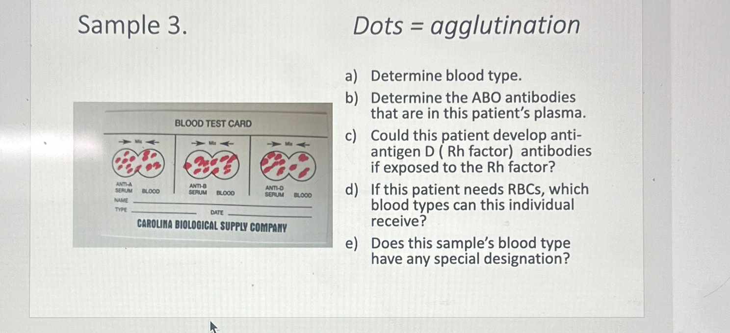 Solved Sample 3.Dots = ﻿agglutinationa) ﻿Determine blood | Chegg.com