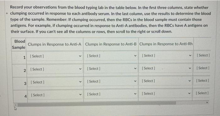 Solved Record your observations from the blood typing lab in | Chegg.com