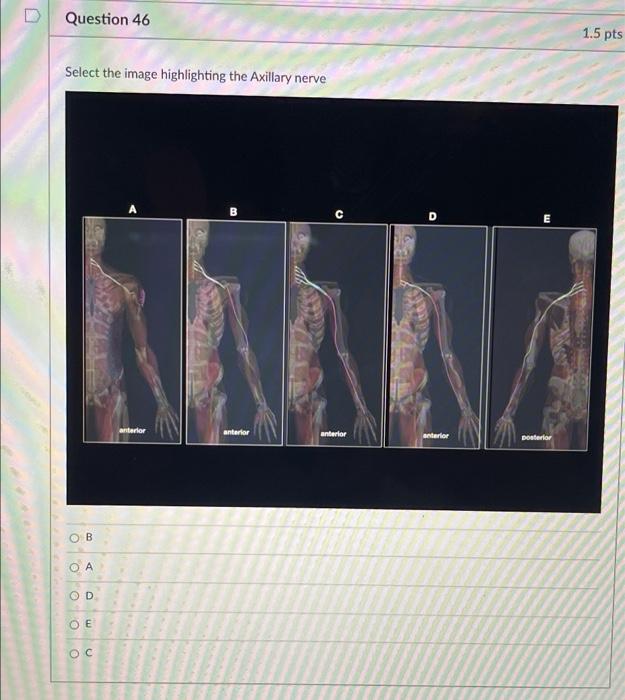 Solved U Question 46 1.5 pts Select the image highlighting | Chegg.com