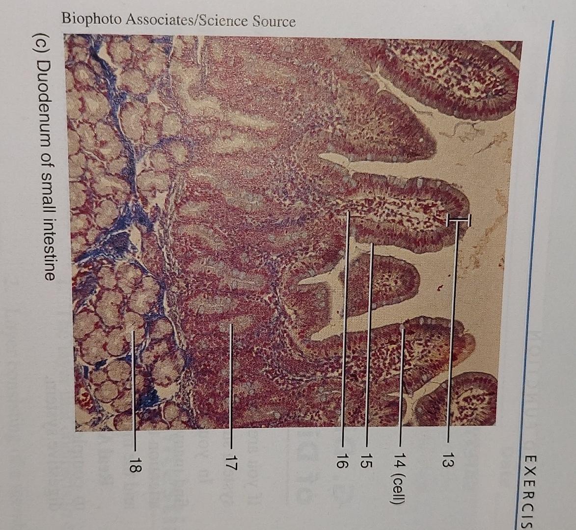Solved Biophoto Associates/Science Source (c) - duodenal | Chegg.com