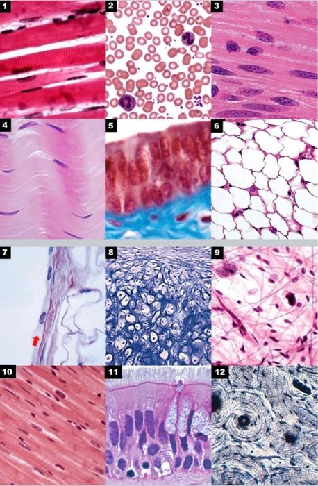 Solved Major type Specific type Simple squamous epithelium | Chegg.com