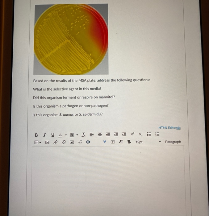Solved Based on the results of the MSA plate, address the | Chegg.com