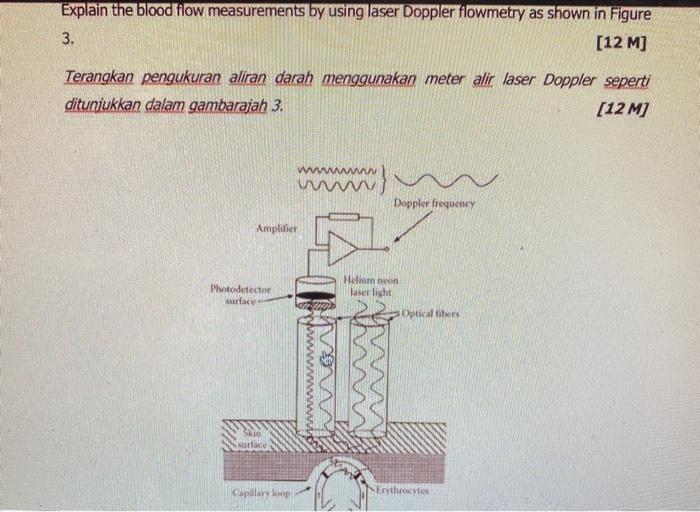 Solved Explain the blood flow measurements by using laser | Chegg.com