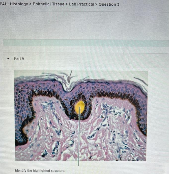 Solved PAL: Histology > Epithelial Tissue > Lab Practical > | Chegg.com