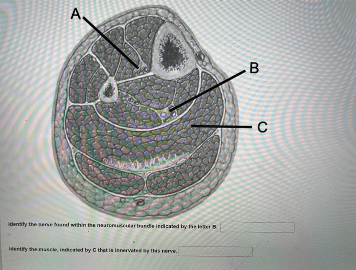 Solved A B o In this transverse section of the leg, identify | Chegg.com