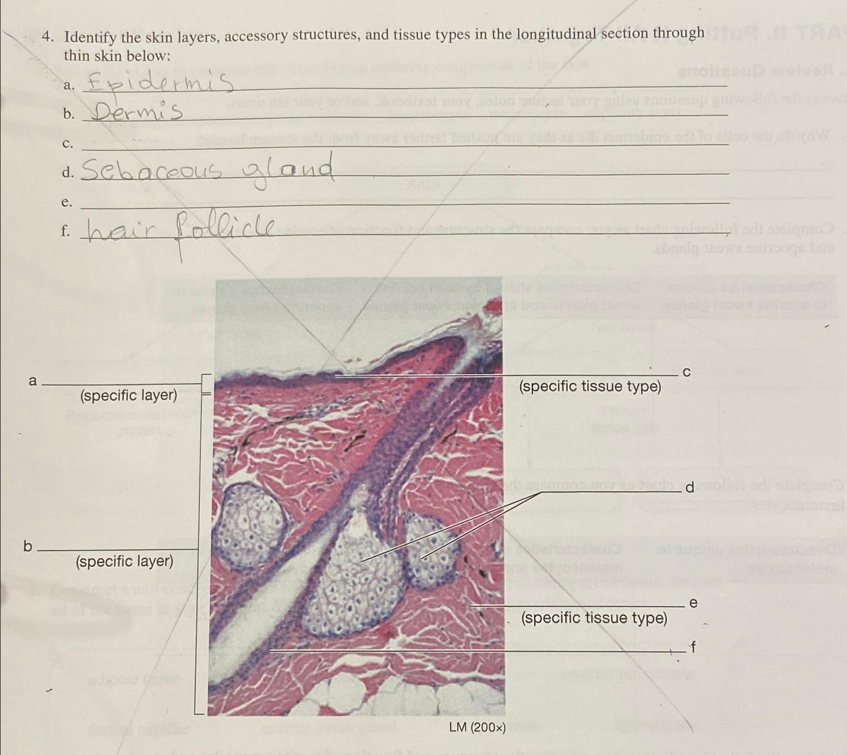 Solved Identify the skin layers, accessory structures, and | Chegg.com Solved Identify the skin layers, accessory structures, and | Chegg.com