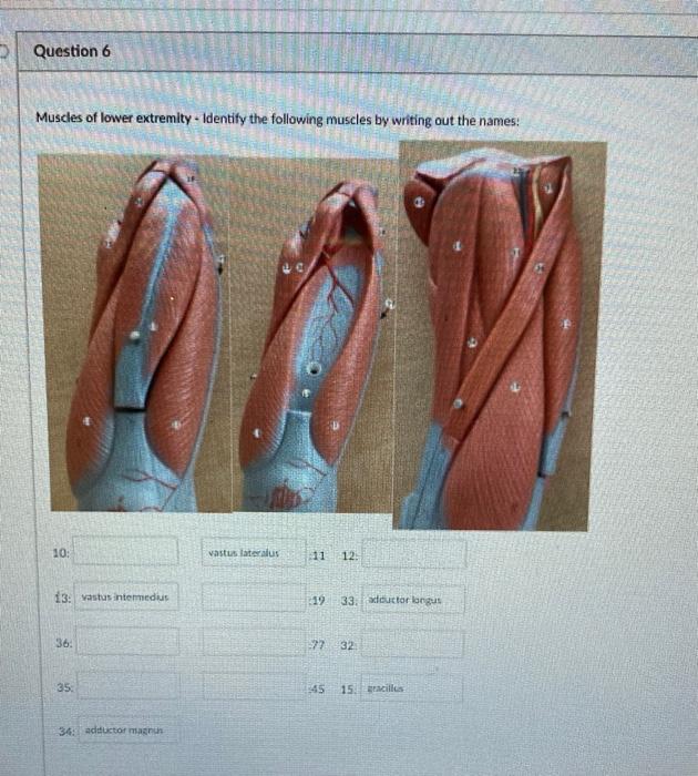 Solved Question 6 Muscles of lower extremity - Identify the | Chegg.com