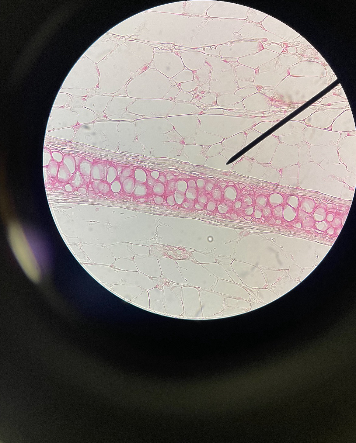 Solved Hyaline Cartilage Locate: (Point out)1.Chondrocytes | Chegg.com
