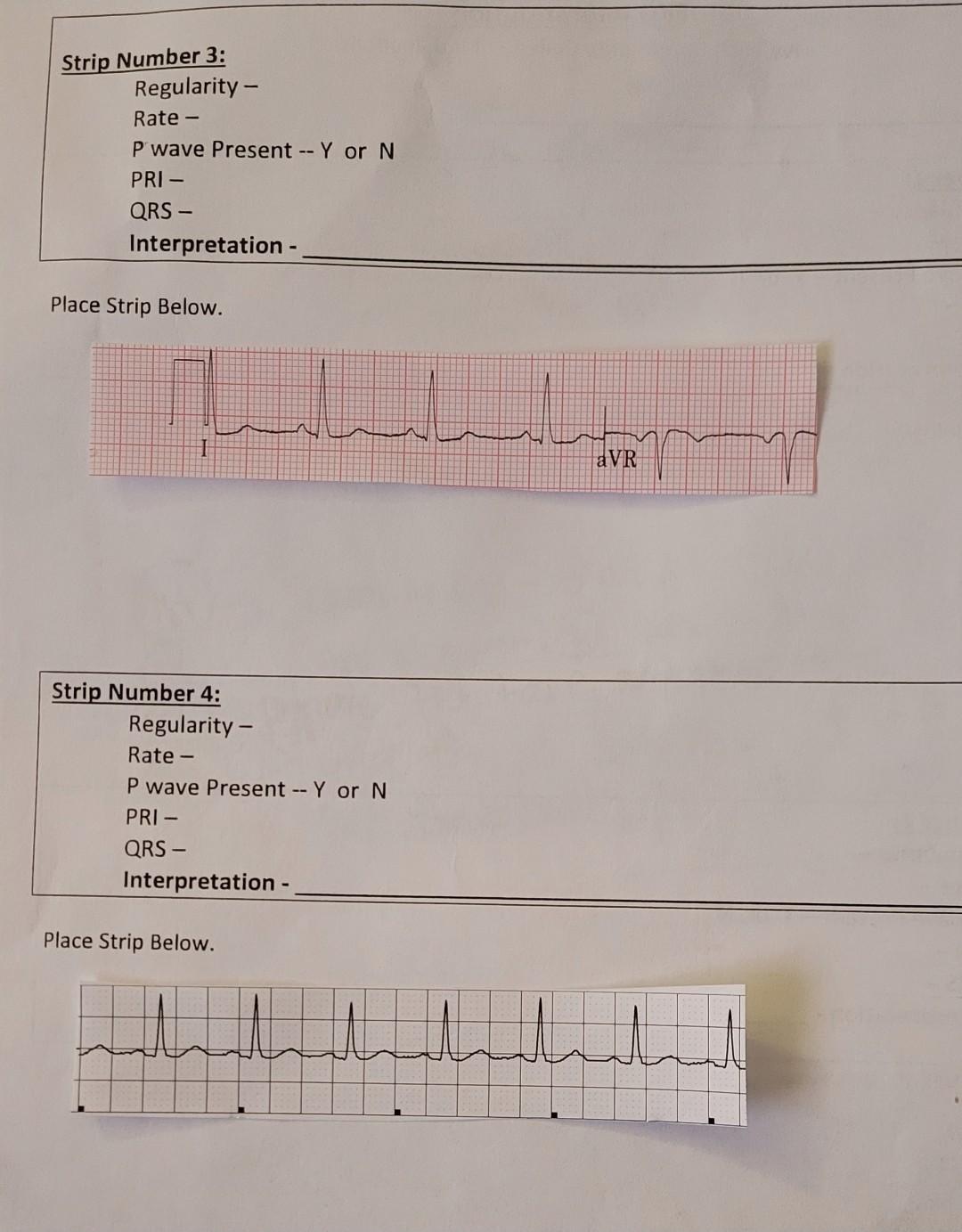 Solved could you please help me with my ekg interpretation. | Chegg.com