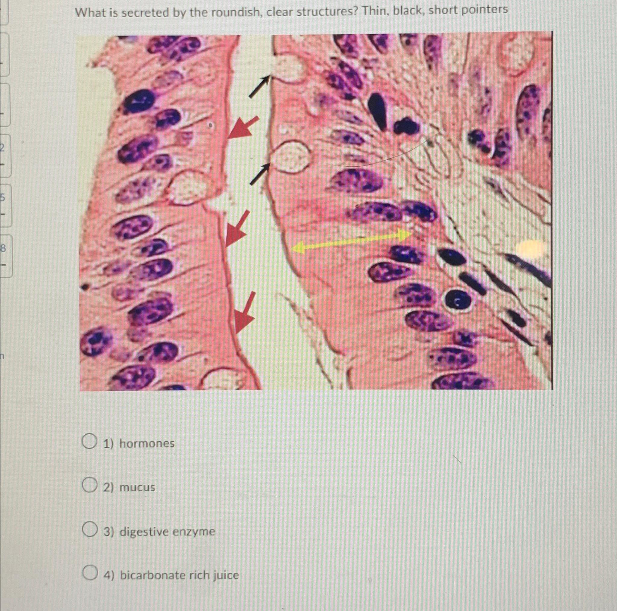 Solved What is secreted by the roundish, clear structures? | Chegg.com