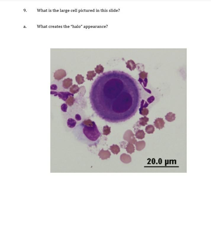 Solved 9. What is the large cell pictured in this slide? a. | Chegg.com