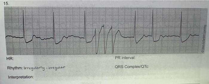 Solved Rhythm: irregularly - irregular Interpretation: 2∘ | Chegg.com