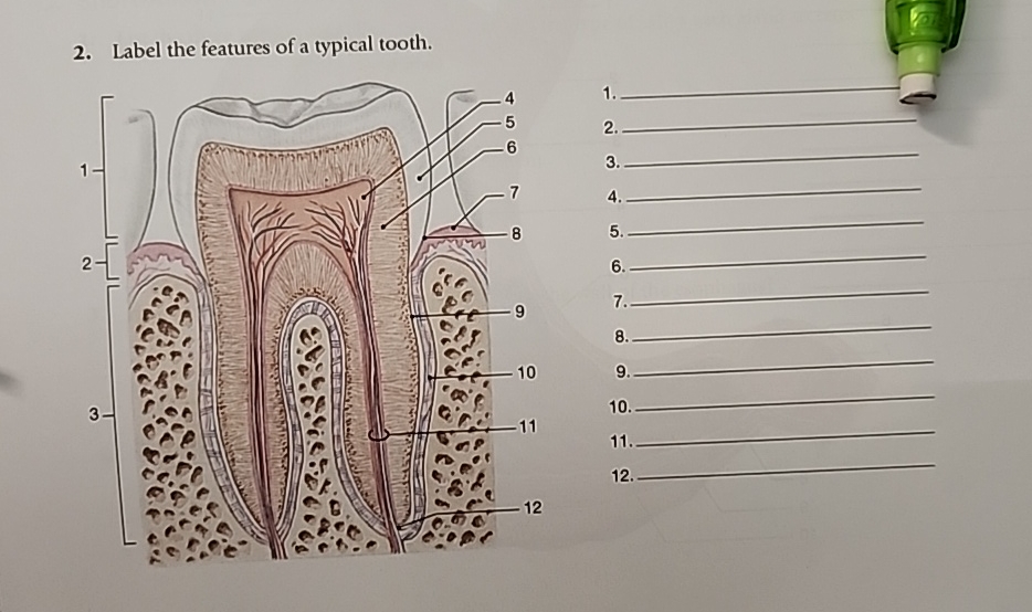 Solved Label the features of a typical | Chegg.com