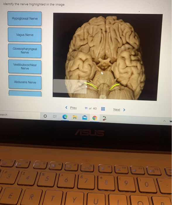 Solved Identify the nerve highlighted in the image. | Chegg.com