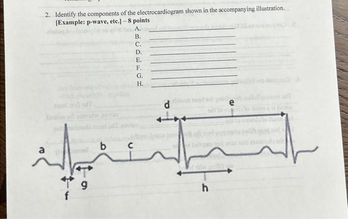 Solved 2. Identify the components of the electrocardiogram | Chegg.com