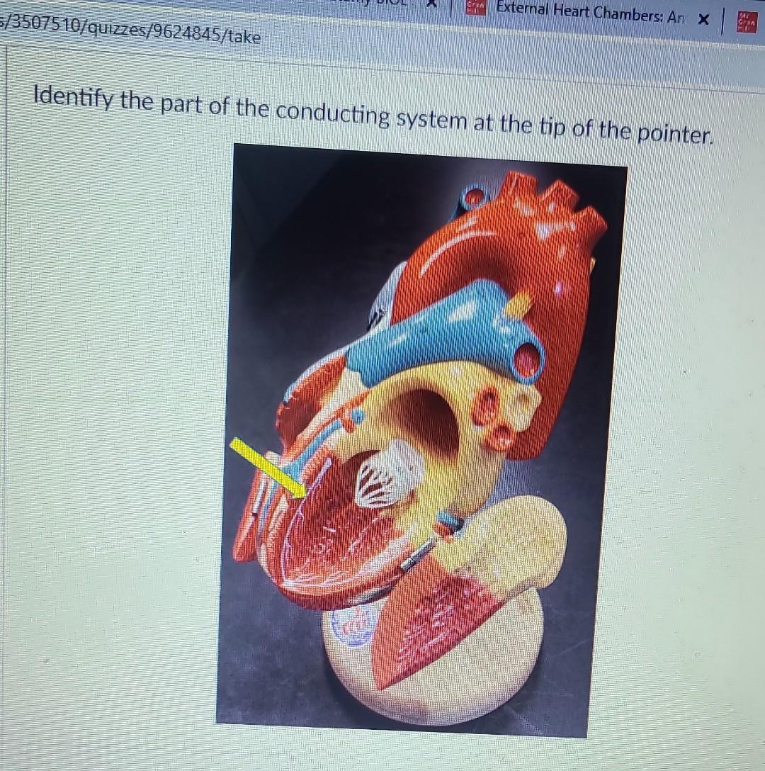 Solved Identify the part of the conducting system at the tip | Chegg.com