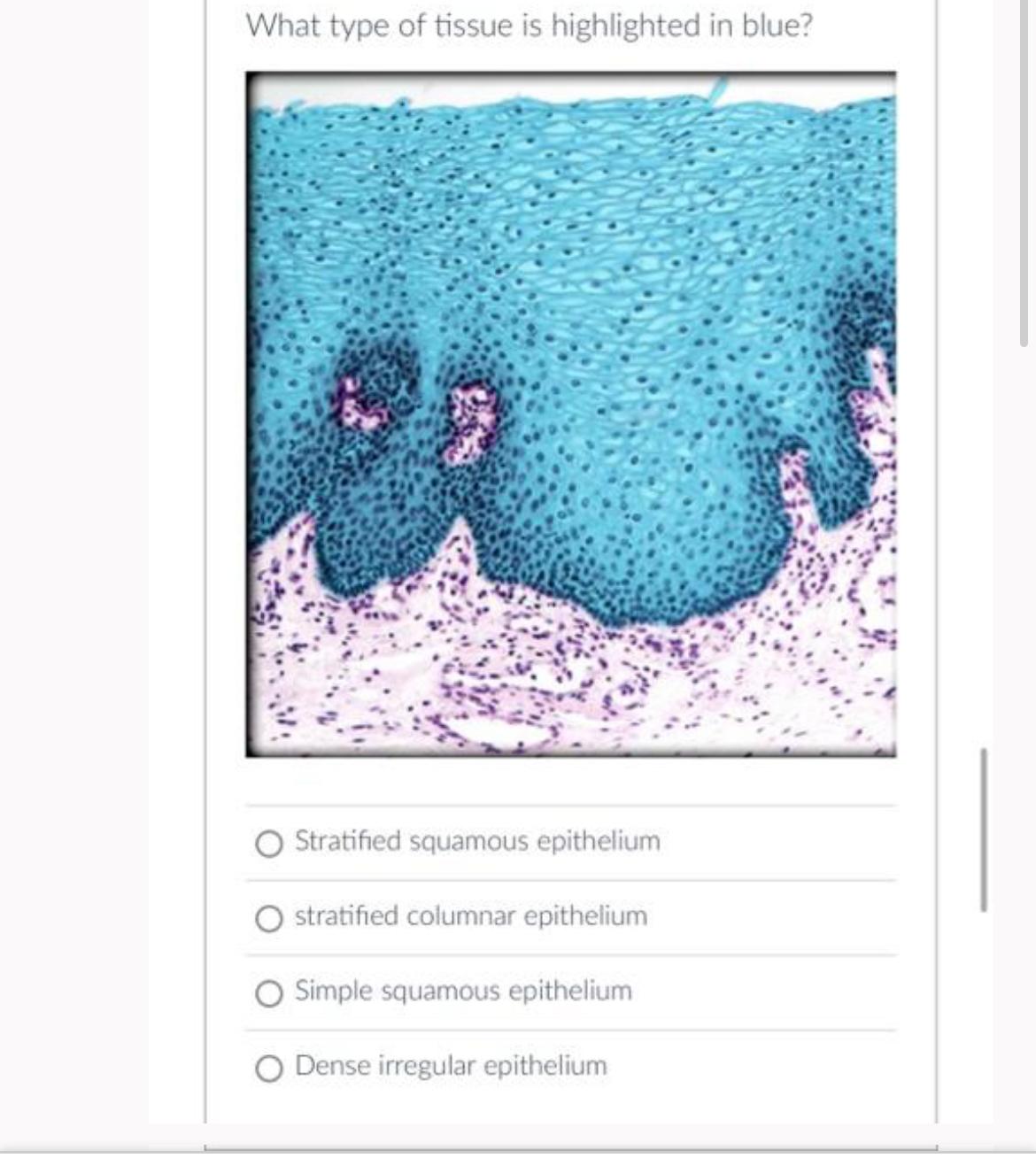 Solved What type of tissue is highlighted in blue?Stratified | Chegg.com