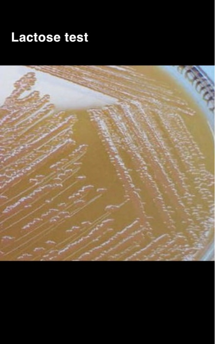 Solved This is unknown gram negative bacteria. A glucose | Chegg.com