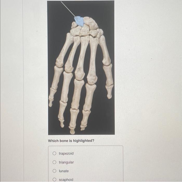 Solved Which bone is highlighted? trapezoid triangular | Chegg.com