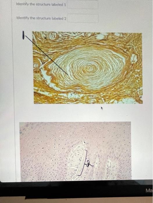 Solved Identify markine Identify marking 3 [R or LIdentify | Chegg.com