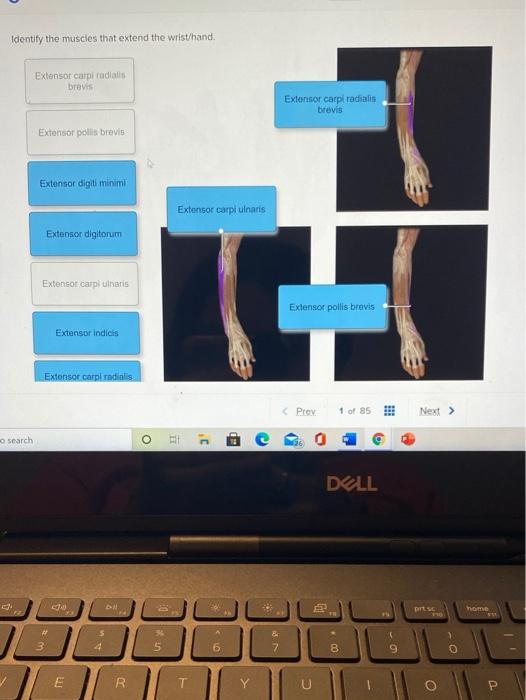 Solved Identify the muscles that extend the wrist/hand. | Chegg.com