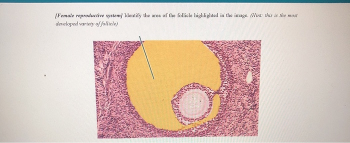 Solved [Female reproductive system, Identify the structure | Chegg.com