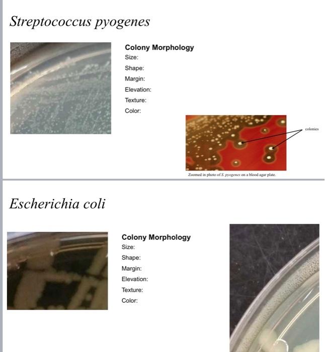 Solved Streptococcus pyogenes Colony Morphology Size: Shape: | Chegg.com