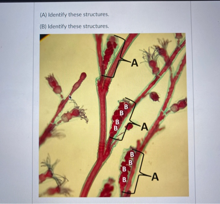 Solved (A) Identify these structures. (B) Identify these | Chegg.com