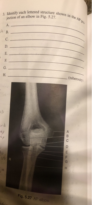 Solved 3. Identity each lettered structure shown in the AP | Chegg.com