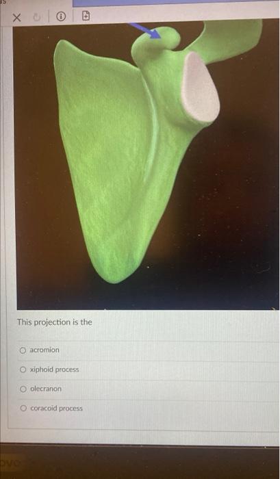 Solved X E This projection is the acromion O xiphoid process | Chegg.com