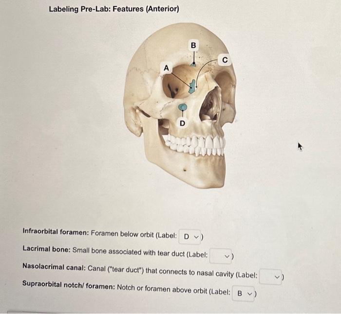 Solved Labeling Pre-Lab: Features (Anterior) Infraorbital | Chegg.com