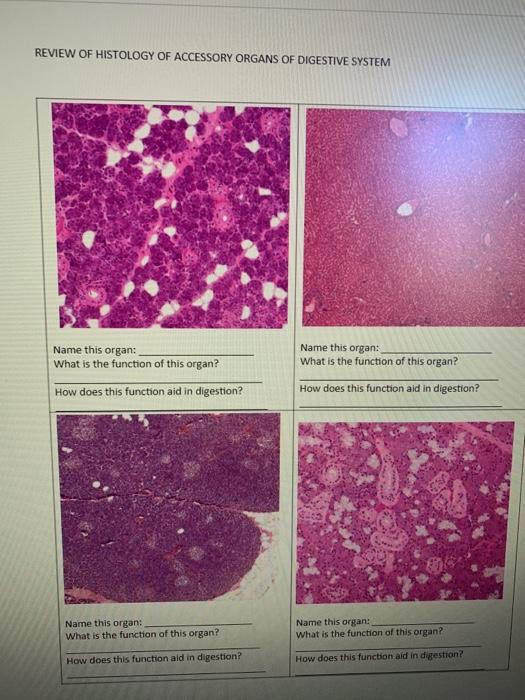 Solved SOS. DOO HISTOLOGY OF THE LIVER Look at the Liver | Chegg.com