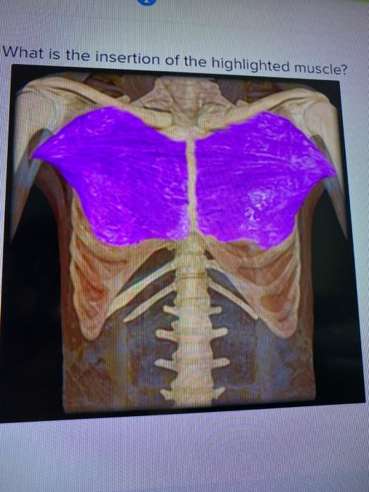 Solved What is the insertion of the highlighted muscle? w | Chegg.com