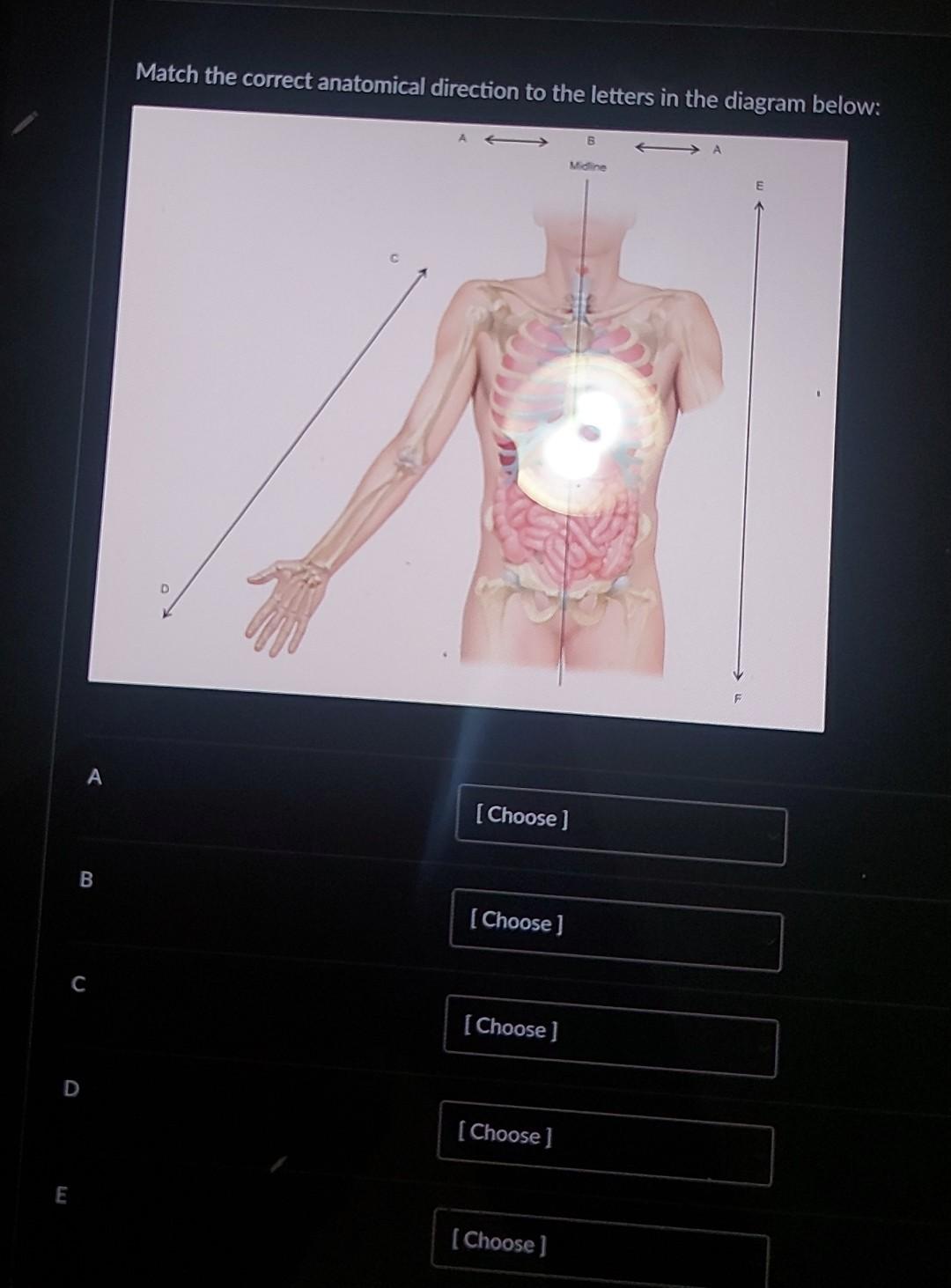 Solved Match The Correct Anatomical Direction To The Letters