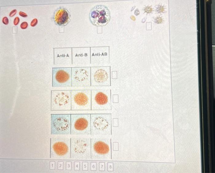 Solved Drag and drop the correct number that matches the | Chegg.com