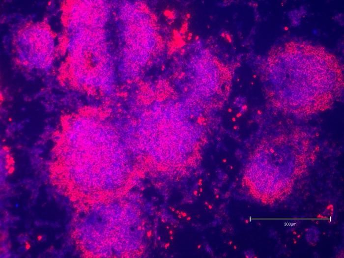 Solved a B cell follicle. label the marginal zone, mantle | Chegg.com