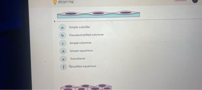 Solved a Simple cuboida! b Pseudostratified columnar c | Chegg.com