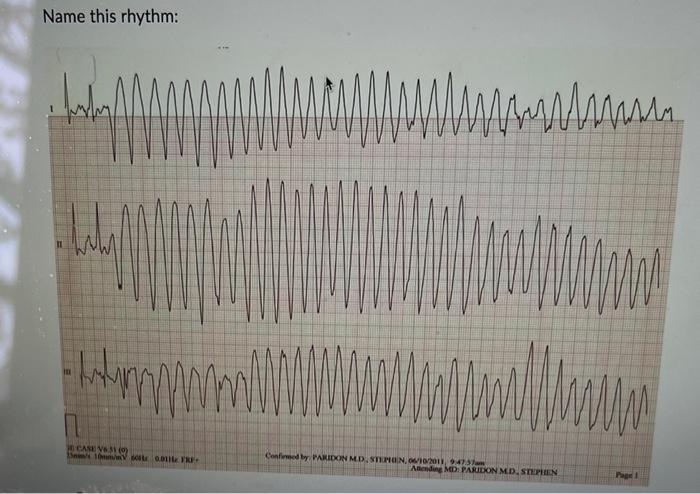 Solved Name this rhythm: SVT WPW VT VF | Chegg.com